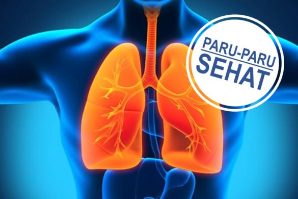 Apa itu TOSS TBC dan Kenali Gejala TBC - Patriot