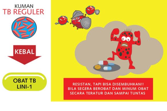 Apa itu TOSS TBC dan Kenali Gejala TBC - Patriot